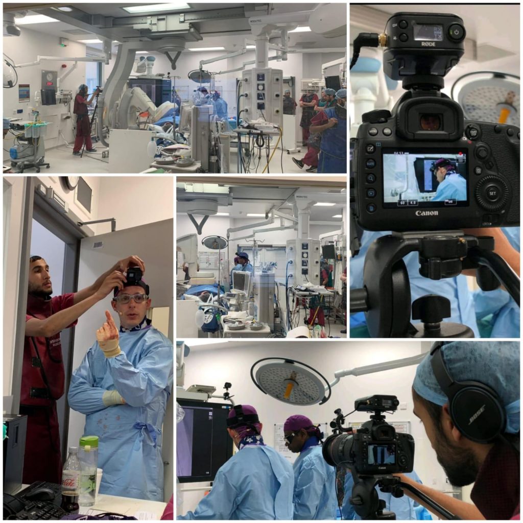 Lower Limb challenging Arterial Endovascular Recanalisation - Dottore ...